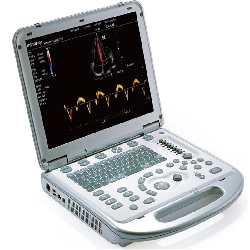 迈瑞(mindray)标配报价_参数_图片_视频_怎么样_问答-苏宁易购