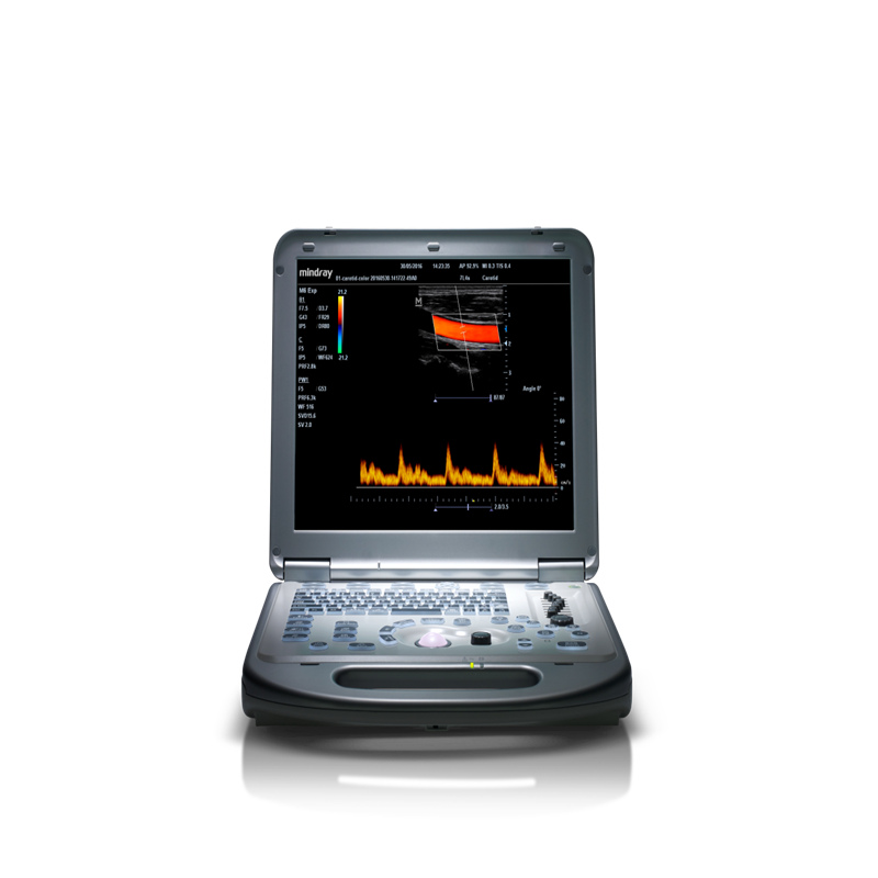 迈瑞(mindray)标配报价_参数_图片_视频_怎么样_问答-苏宁易购